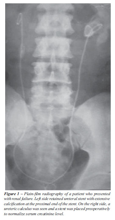 International Braz J Urol